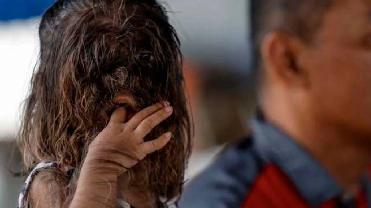 La niña con «síndrome de hombre lobo» - El Diario Nica